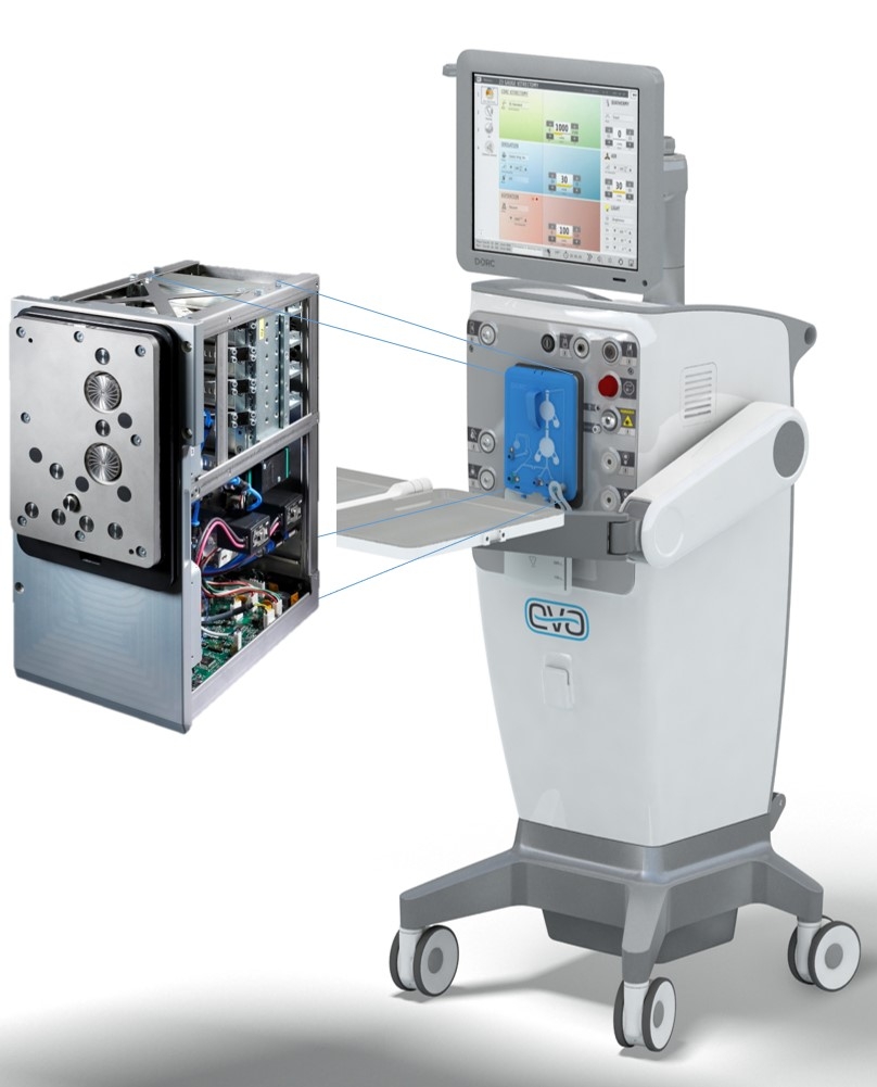 fluidic eye surgery pump